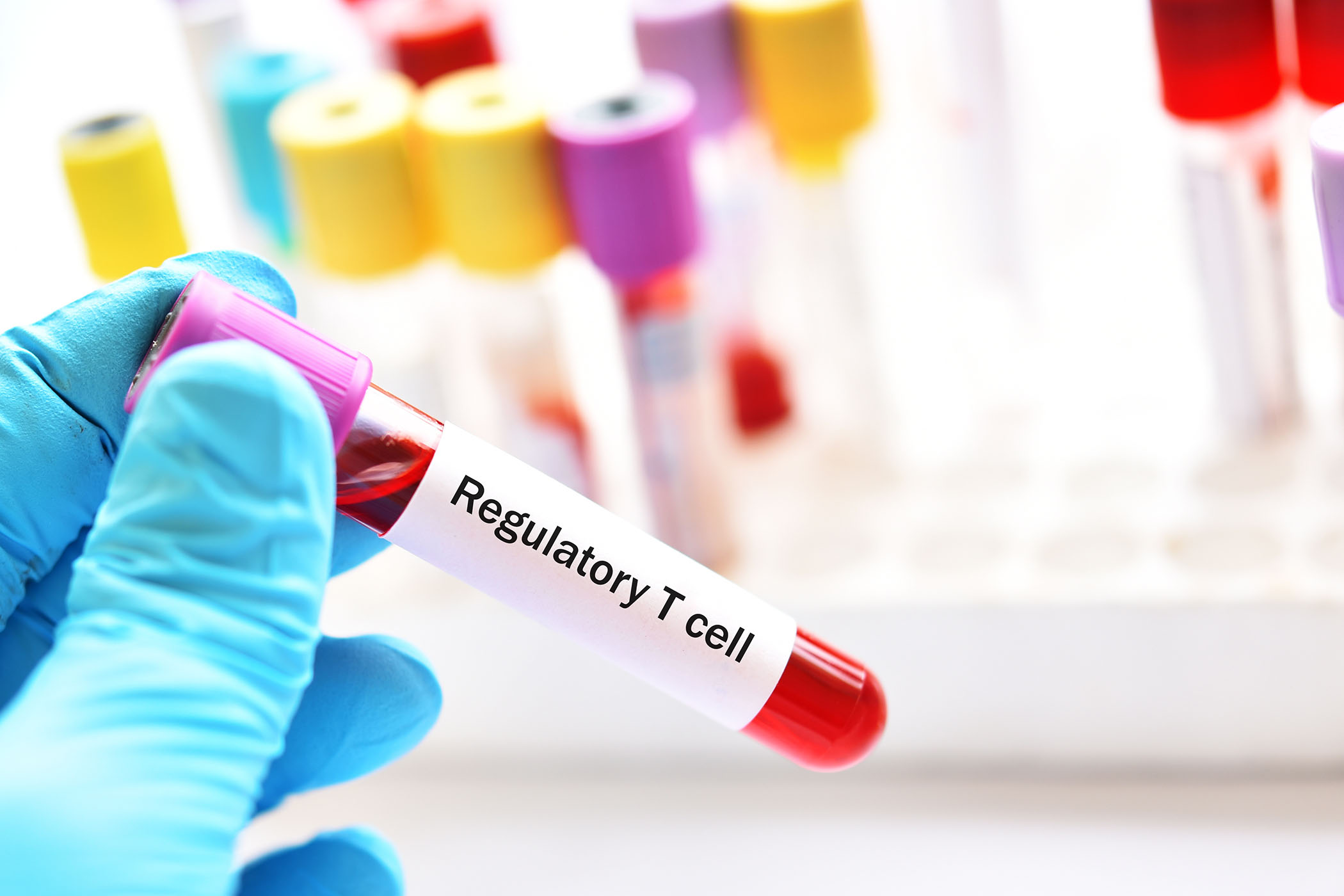 Testing a Revolutionary Treatment Against Progressive Multiple ...